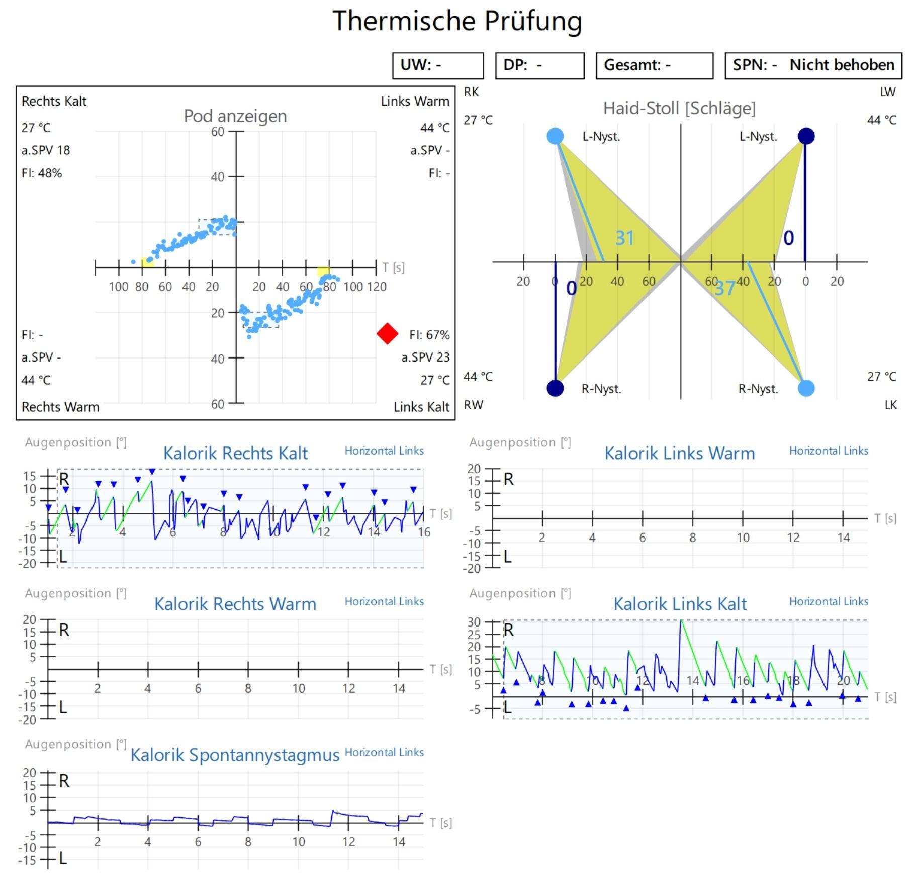 VNG – Videonystagmographie – HNO Zentrum Hof